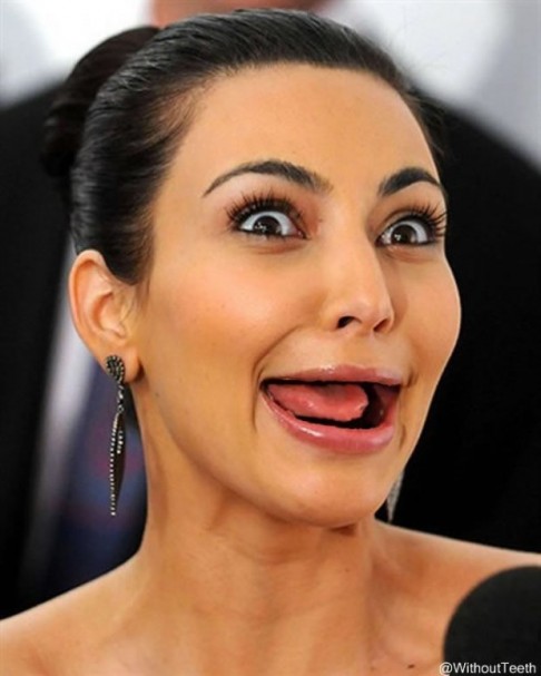 21 Toothless Celebrity Pictures Will Have You In Tears Of Laughter